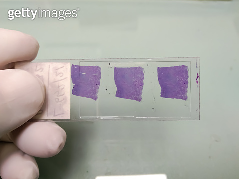 Histological Hematoxylin and eosin stained microscopic slides. Isolated ...