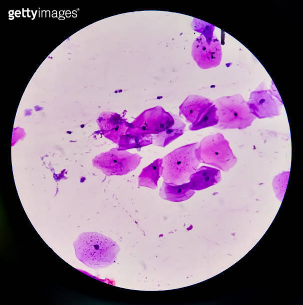 Buccal smear showing desquamated squamous cells of the oral mucosae ...