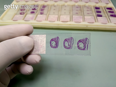 Histological Hematoxylin and eosin stained microscopic slides. Isolated ...