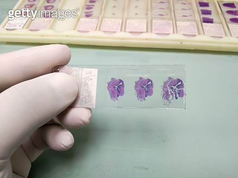 Histological Hematoxylin and eosin stained microscopic slides. Isolated ...