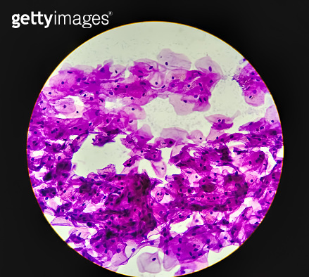 Microscopic view of normal human cervix cells. Squamous epithelium ...