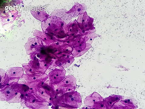 Microscopic view of normal human cervix cells. Squamous epithelium ...
