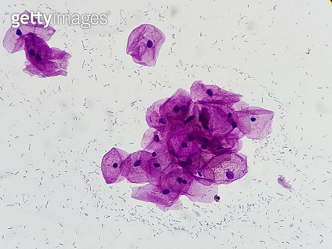 Microscopic view of normal human cervix cells. Squamous epithelium ...