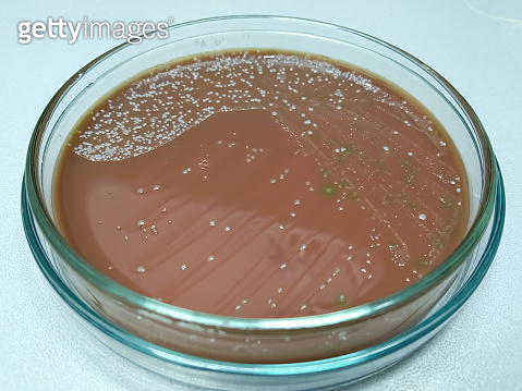 Chocolate agar medium growth of streptococcus pneumoniae ...