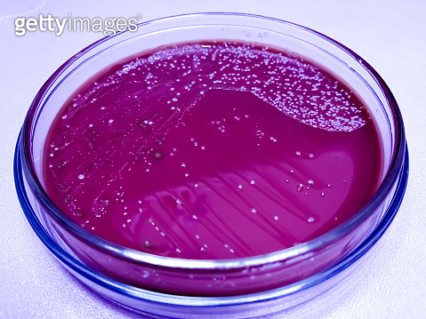 Chocolate agar medium growth of streptococcus pneumoniae ...