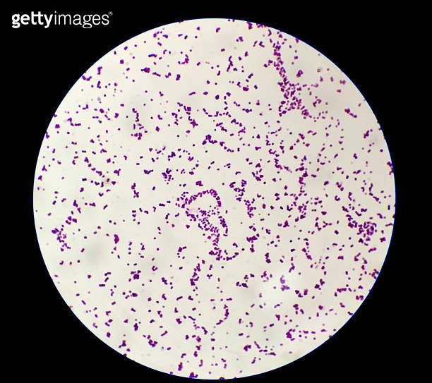 Gram-positive bacteria Streptococcus pyogenes which cause Scarlet fever ...