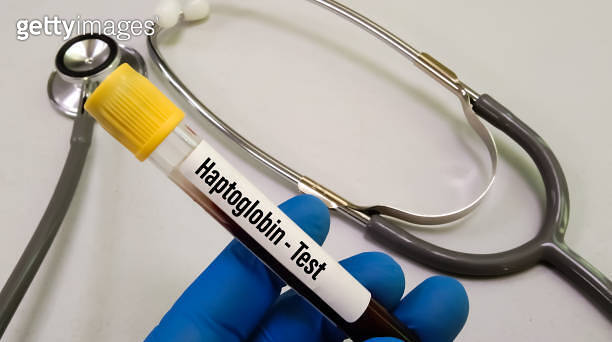 Blood sample tube for Haptoglobin test. 이미지 (1343793495) - 게티이미지뱅크