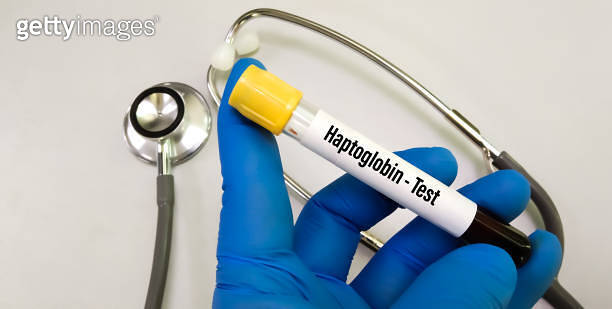 Blood sample tube for Haptoglobin test. (1343793535) - 게티이미지뱅크