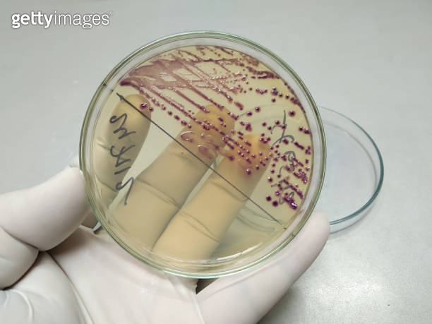 Culture and Sensitive test with urine specimen on Hi chrome, UTI agar ...