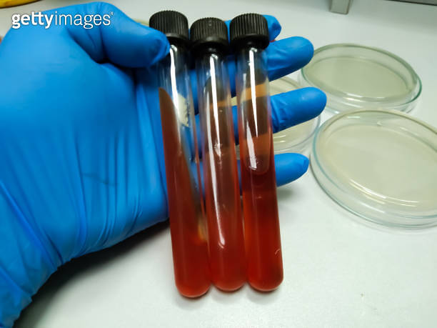 The Triple Sugar Iron (TSI) test is a microbiological test named for ...