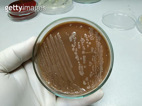 Culture and sensitive test at medical microbiology laboratory growth of ...