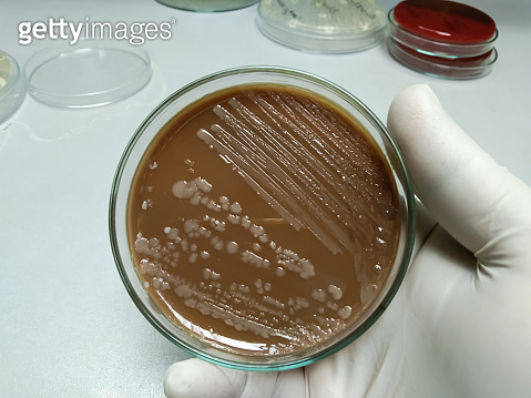 Culture and sensitive test at medical microbiology laboratory growth of ...