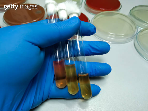 MIU Medium Base (Motility Indole Urea Medium) is a semisolid medium ...