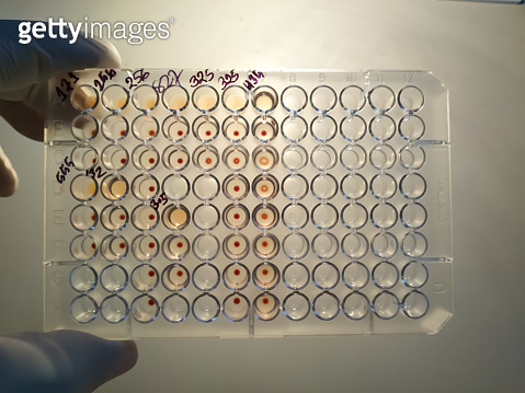Test plate for Treponema pallidum haemagglutination (TPHA) test. 이미지 ...