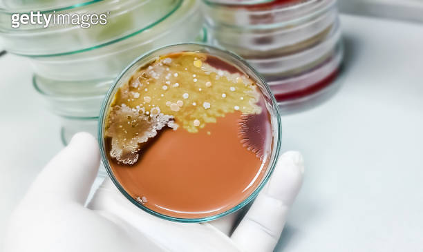 Colonies of Candida Albicans growth on Chocolate agar 이미지 (1341661118 ...