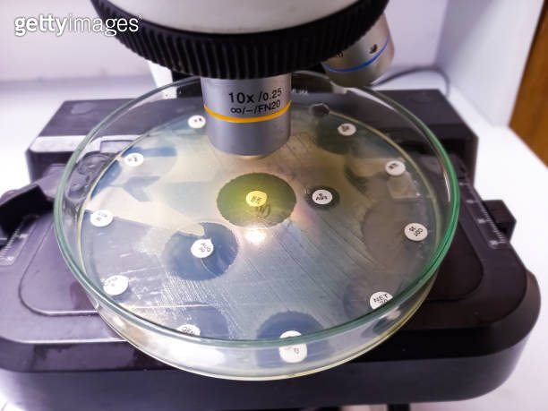 Antimicrobial susceptibility testing in culture plate. Drug sensitivity ...