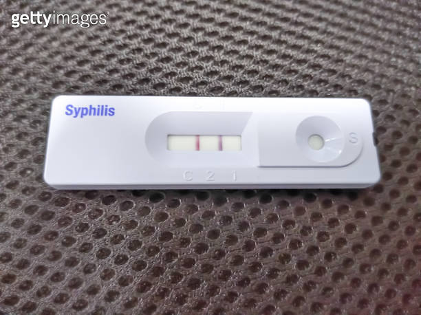 Rapid test cassette for Syphilis test(TPHA) ,The result showed Positive ...