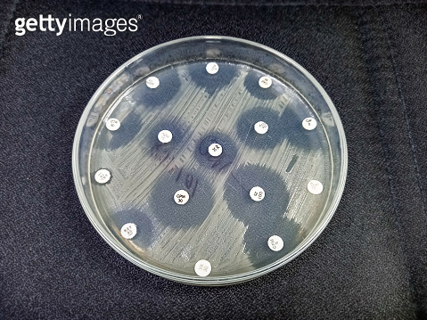 Antimicrobial susceptibility testing in culture plate. Drug sensitivity ...