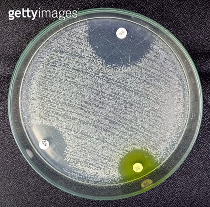 Antimicrobial susceptibility testing in culture plate. Drug sensitivity ...