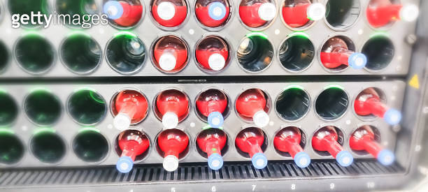 Blood culture machine with sample for detection of Bacteria in blood ...