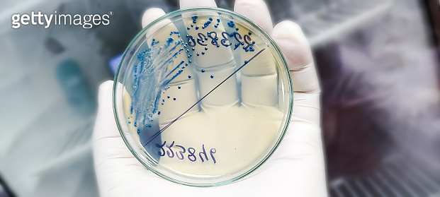 Enterobacter colonies, GNR, Gram negative Rods colonies as test on ...