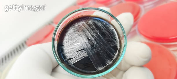 Bile esculin agar (BEA) is a selective media for Enterococci spp ...