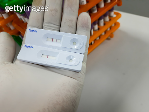 Rapid test cassette for Syphilis test, Rapid TPHA test, positive and ...