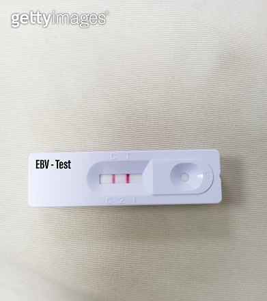 Rapid blood test of EBV or Epstein-Barr virus test, Mono spot ...