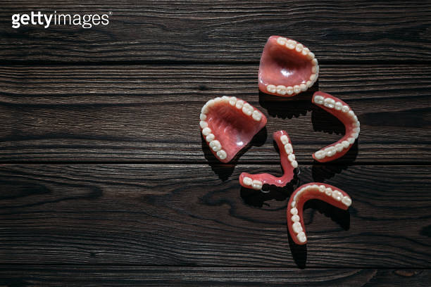 Dentures on a dark background. Close-up of dentures. Full removable ...