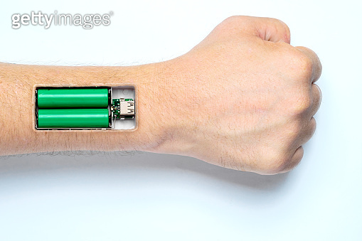 Rechargeable batteries in a battery pack implanted in a human hand ...