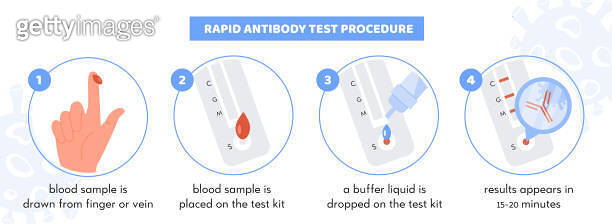 Covid-19 Rapid Antibody test procedure Infographic. Test kit with ...