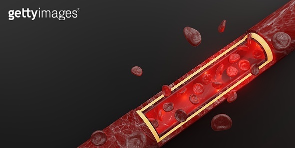 red blood cells skin layer veins 3d illustration intravascular surgery ...