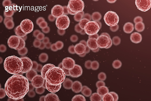 Sick cancer cells under a microscope (1345672068) 일러스트, 무료 일러스트 - 게티이미지뱅크