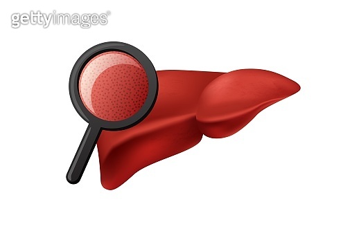 Examination of damaged liver cells. Enhances magnifier human red liver ...