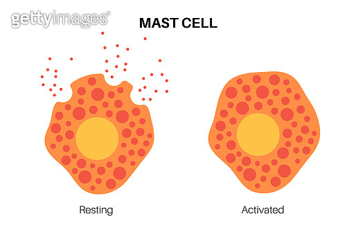 Mast cell poster (1360089752) 일러스트, 무료 일러스트, 아이콘, 무료 아이콘 - 게티이미지뱅크