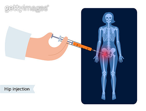 Hip joint injection 이미지 (1323410120) - 게티이미지뱅크