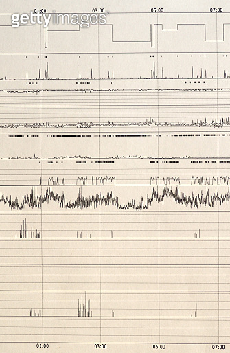 polysomnography (PSG) sleep study (1321994503) - 게티이미지뱅크