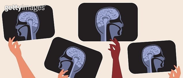 Mri brain scans, flat vector stock illustration with concept of ...