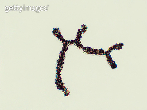 Microcystis sp. algae under microscopic view, freshwater cyanobacteria ...