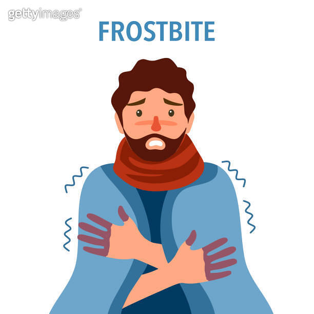 Man suffering from frostbite. Guy with frozen hands in winter season in ...