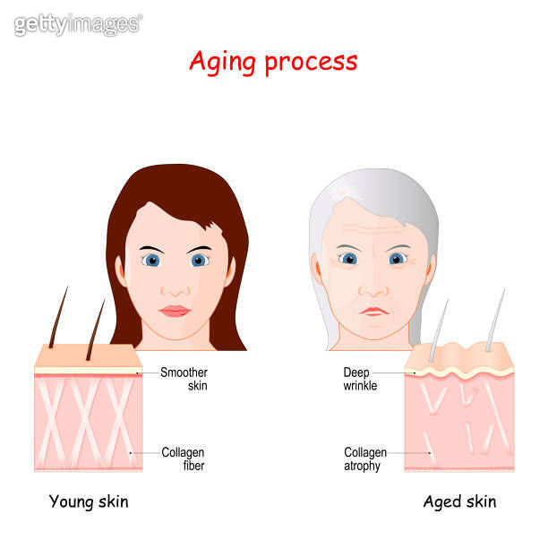 skin Aging process. 이미지 (1294610436) - 게티이미지뱅크