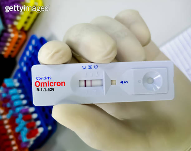 The Researcher hold Rapid test cassette for new variant of the Covid-19 ...
