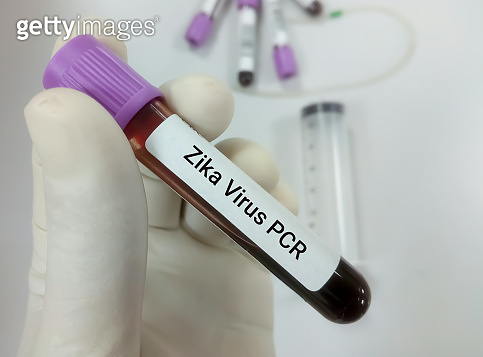 Biochemist hold blood sample for Zika virus PCR test, blur background ...