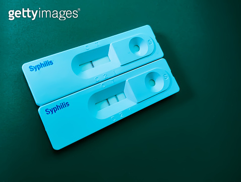 Top close view of the testing devices of Syphilis, rapid screening test ...