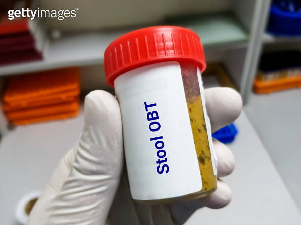 Doctor holding stool sample container for occult blood test (OBT). OBT ...