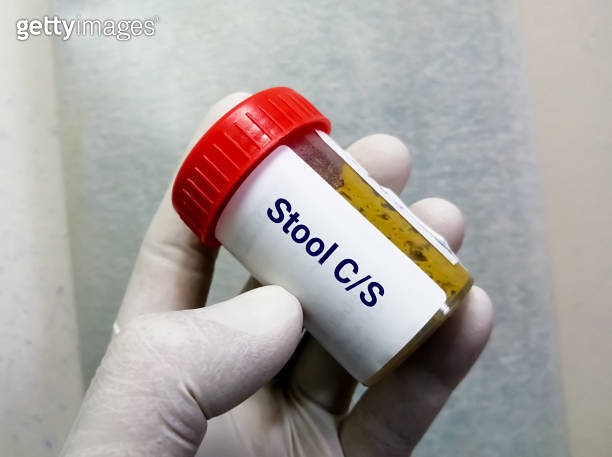 Microbiologist holding stool container with specimen for culture and ...