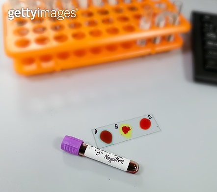 Blood group and Rh factor testing by slide agglutination method with ...