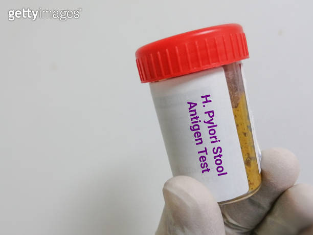 H. Pylori Stool Antigen Test. Helicobacter Pylori. Diagnosis for peptic ...