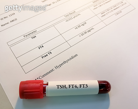 Blood sample for TSH, FT4, FT3 test with laboratory report ...