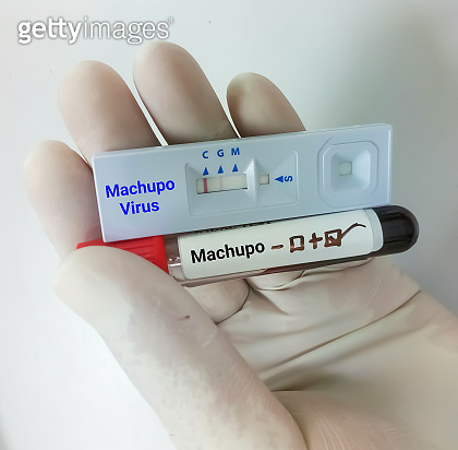 Scientist hold blood sample and rapid test cassette for Machupo virus ...